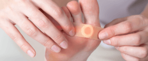Plantar Warts Can Be Stubborn, But There Are Several Treatment Options ...